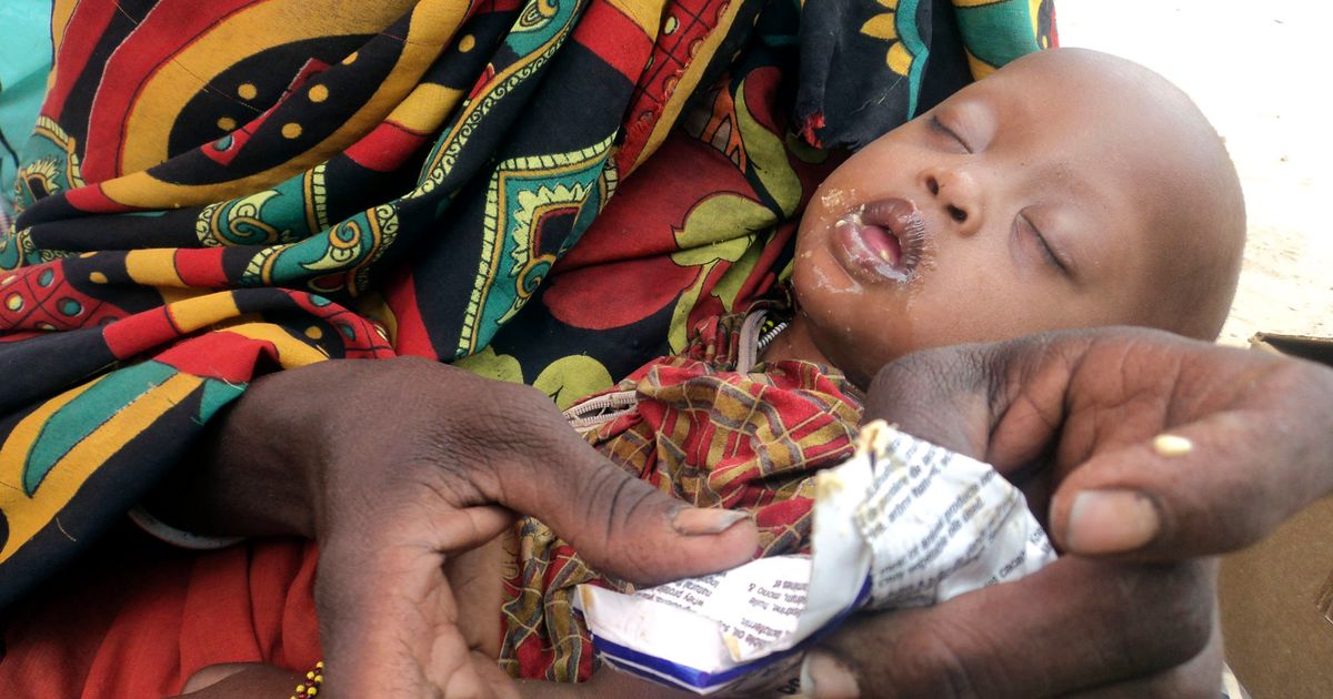 Global Hunger: Calamitous famine eradicated in last 50 years | The ...