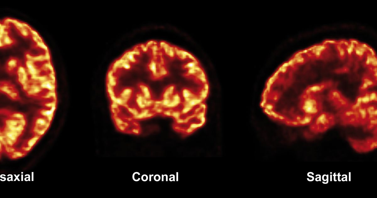 New technique opens window into how brain cells communicate | The ...