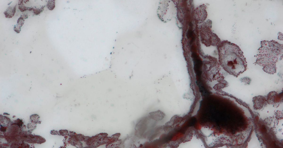 Tiny tubes in Canadian rock may be oldest known fossils | The Seattle Times