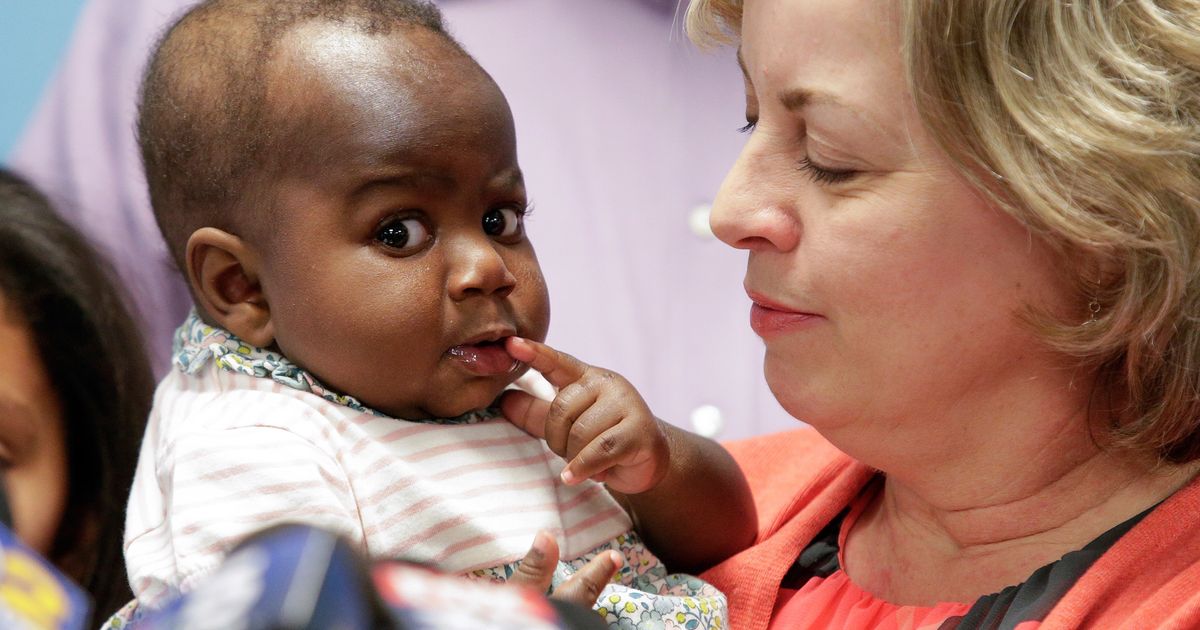 Baby born with 4 legs is recovering after rare surgery in Chicago | The ...