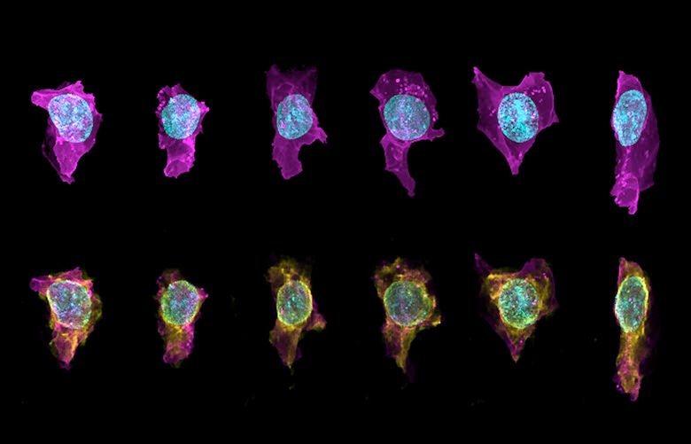 Paul Allen’s latest science project: a psychedelic way to peer inside ...