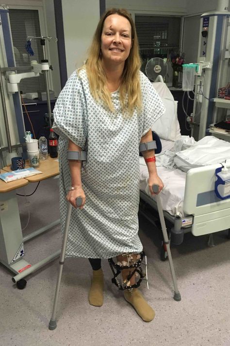 London attack victim stands on her own after broken leg | The Seattle Times