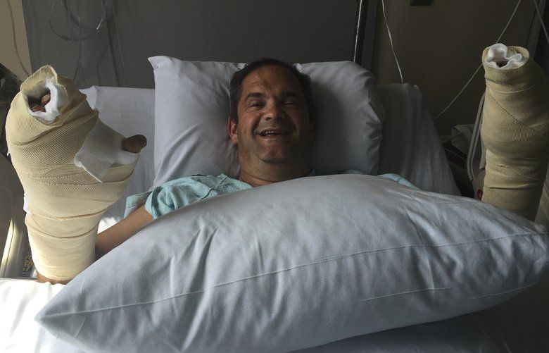 This type of firework disfigures people more than any other, UW study ...