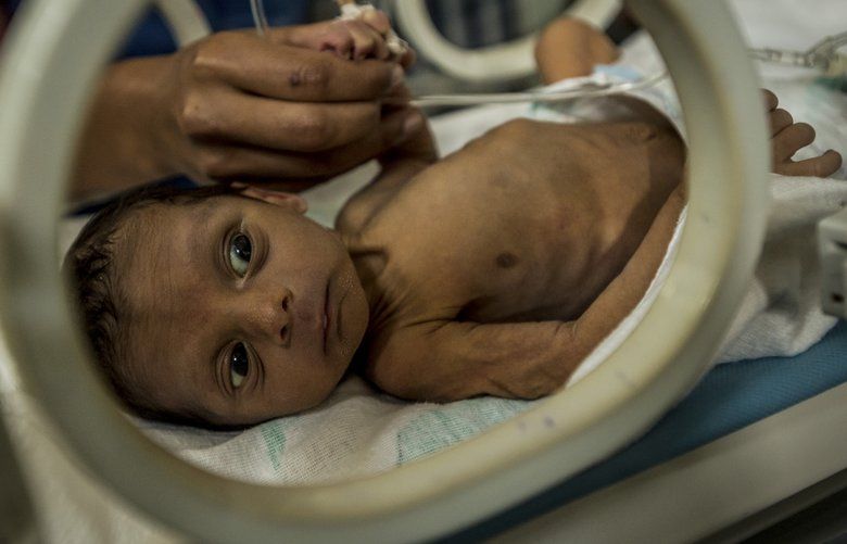 As Venezuela collapses, its children are dying of hunger | The Seattle ...