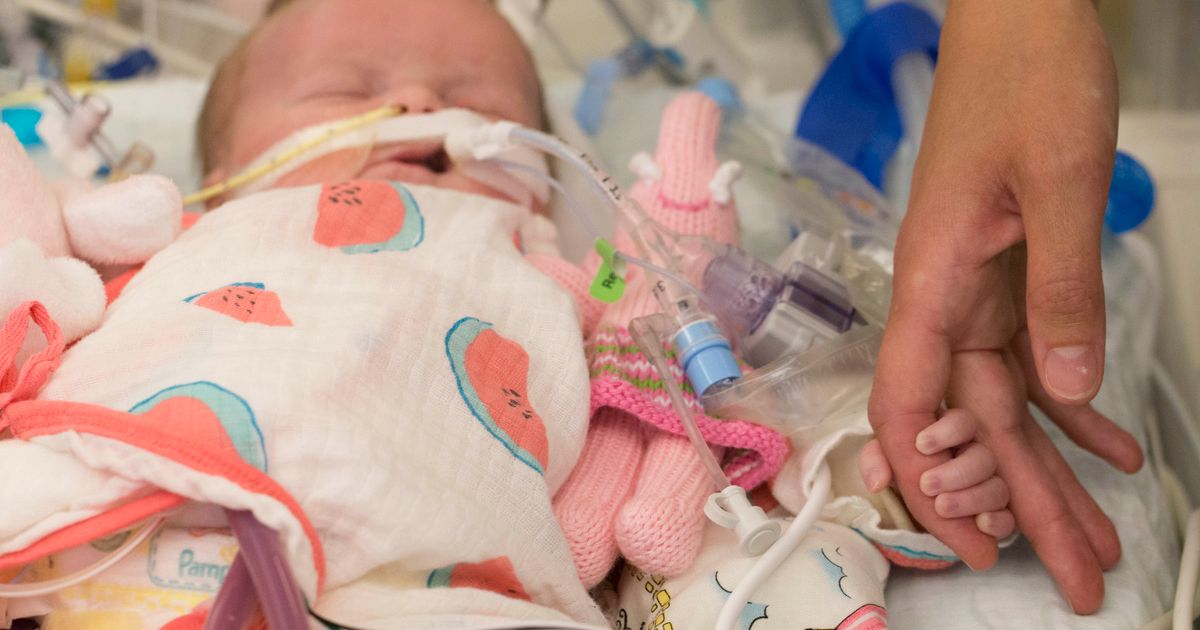 Dying organs restored to life in novel experiments | The Seattle Times