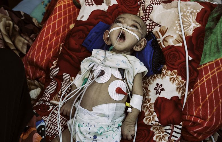 Dying babies and no doctors: A look inside a Yemeni hospital | The ...