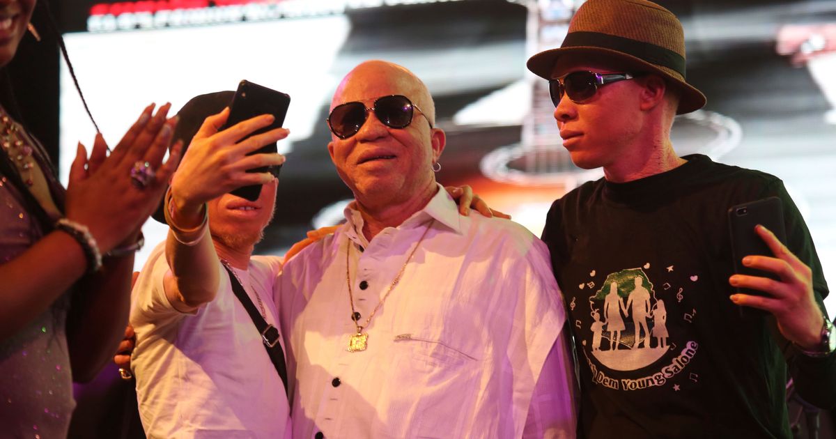 African singer makes persecution of fellow albinos visible | The ...