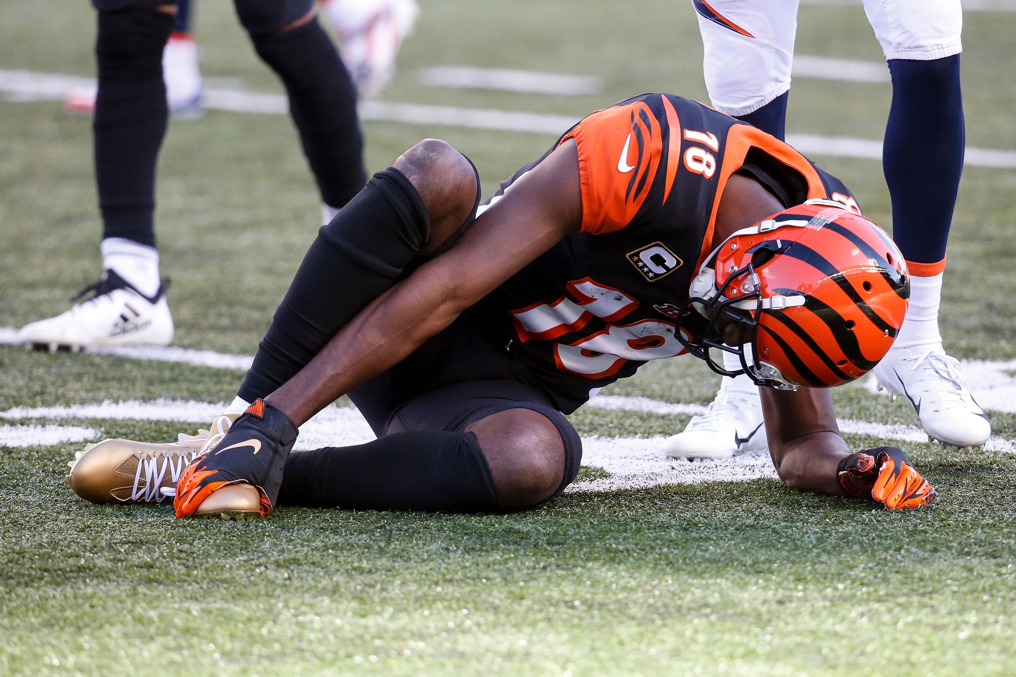 Horrific Nfl Injuries