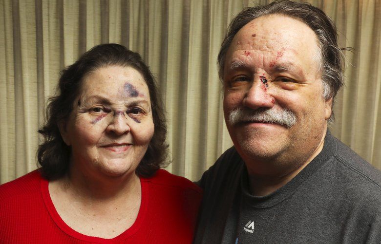 ‘My bruises have bruises’: Couple recovering in good humor after ...