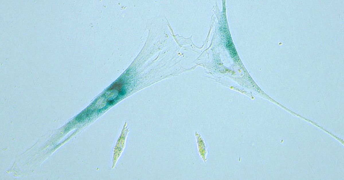 ‘Zombie cells’ buildup in your body may play role in aging | The ...