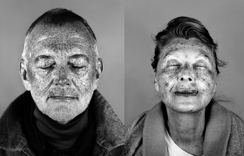 Should you get a scary UV photo of your skin damage? | The Seattle Times