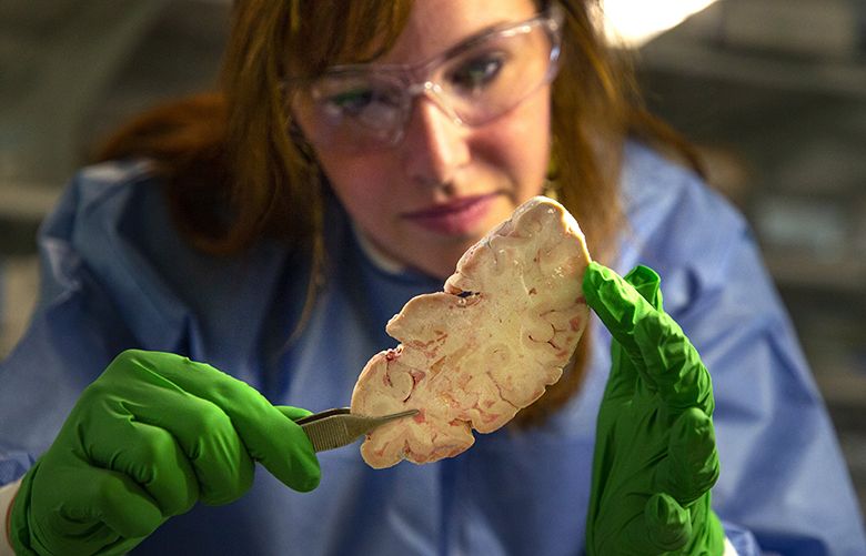 What can mice teach Allen Institute researchers about treating brain ...