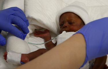 Premature nonuplets born in Morocco are stable but fragile | The ...