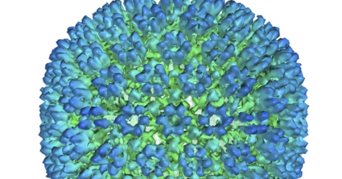 Study: More evidence links a virus to multiple sclerosis | The Seattle ...