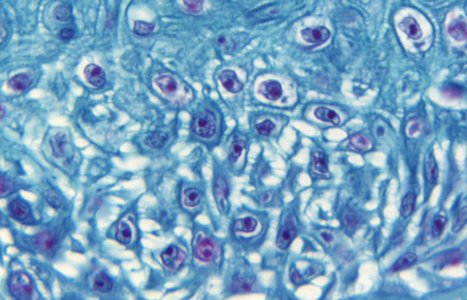 UK reports 104 more cases of monkeypox, mostly in men | The Seattle Times