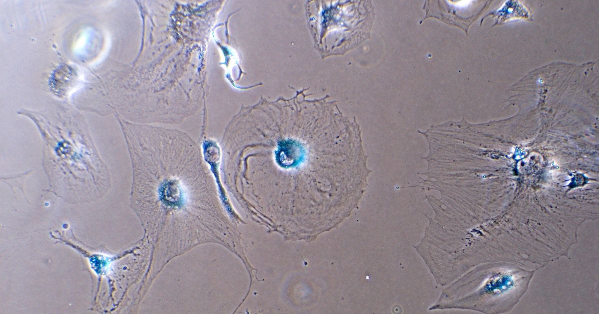 Zombie cells central to the quest for active, vital old age | The ...