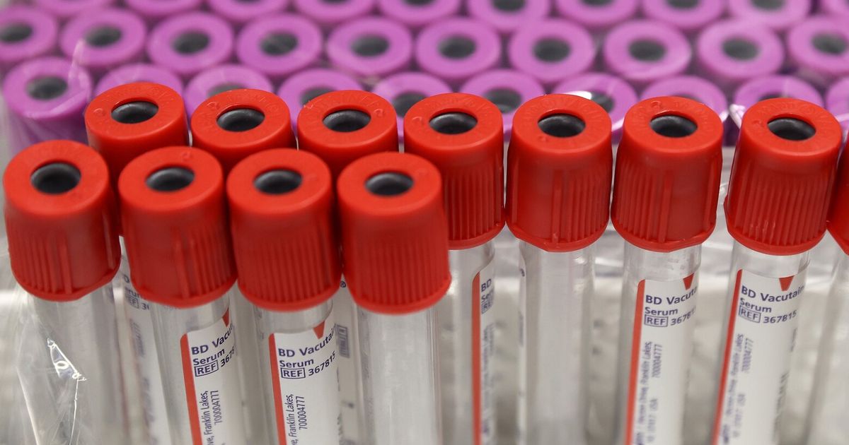 Scientists discover Er, a rare new blood group system | The Seattle Times