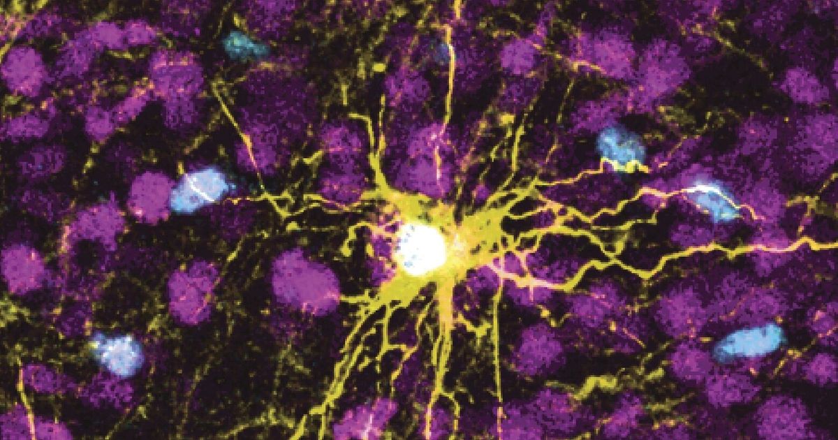 Scientists grow human brain cells in rats to study diseases | The ...