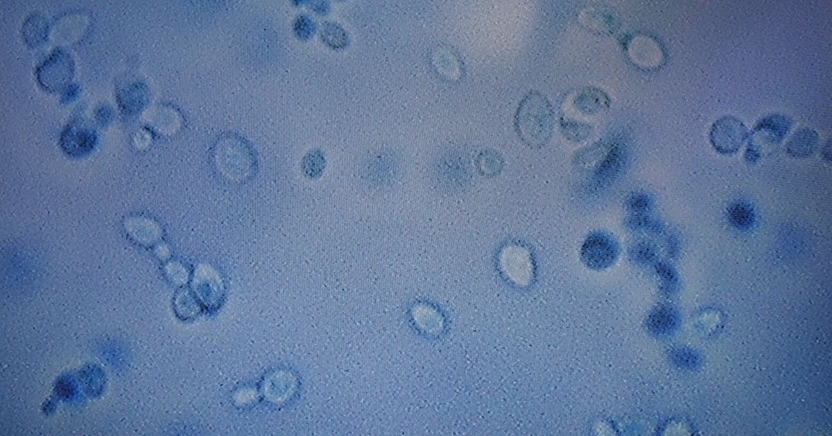 Superbug fungus cases rose dramatically during pandemic | The Seattle Times
