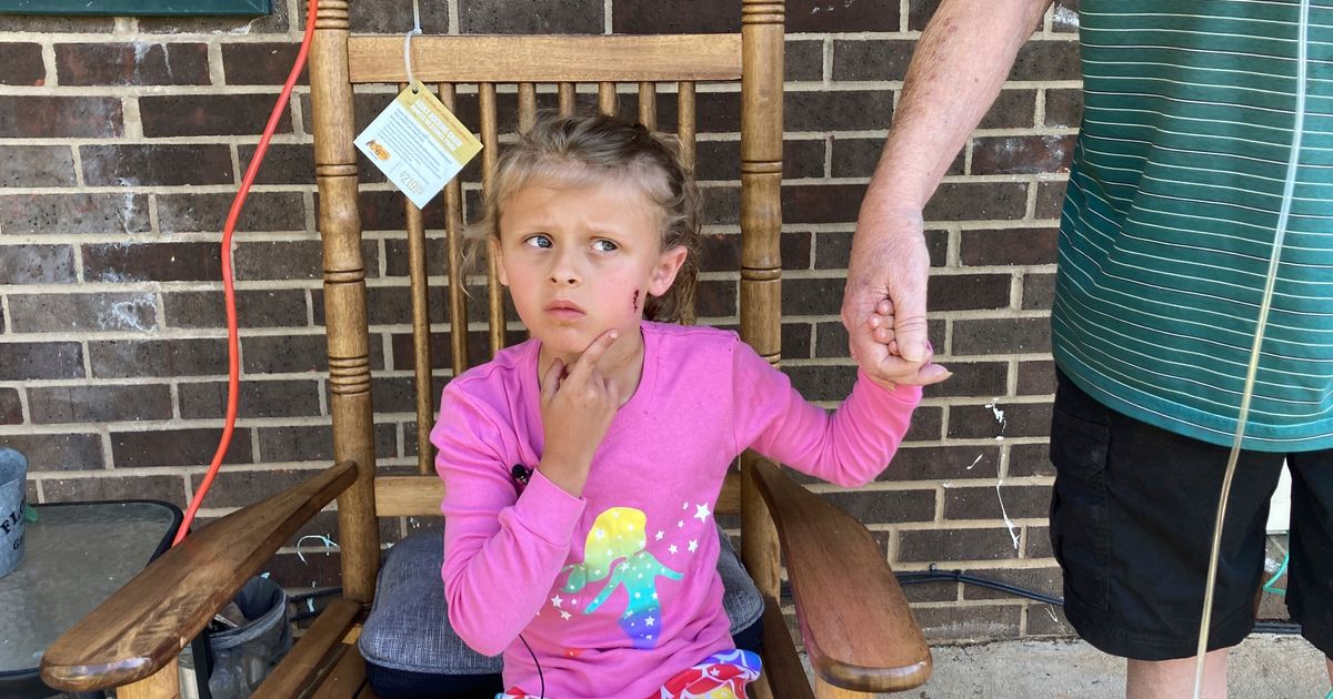 ‘I was on fire’: Dad shot by neighbor while protecting girl | The ...