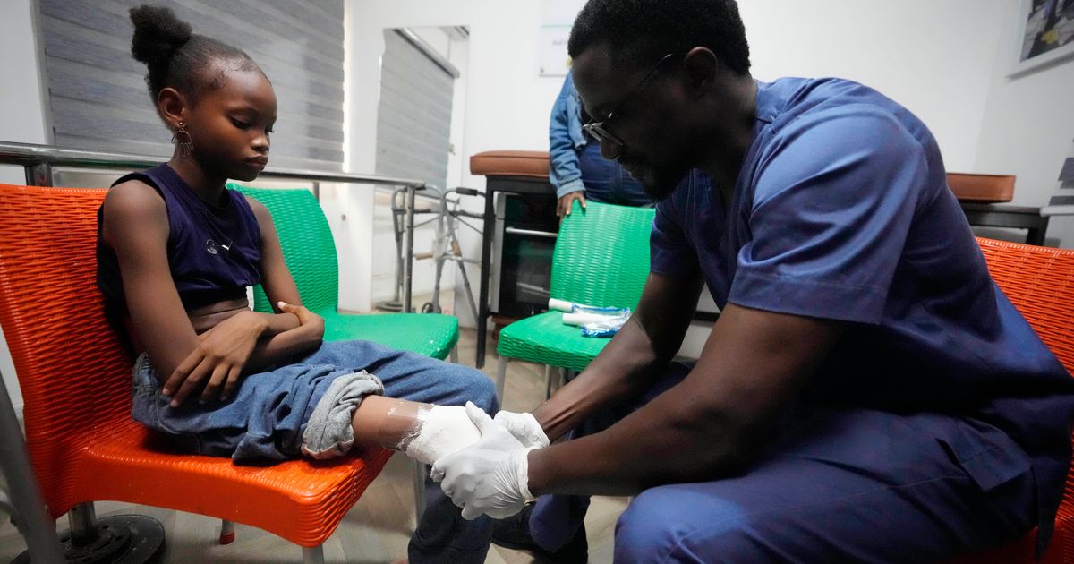 Nigerian group provides hundreds of prosthetic limbs to amputee ...