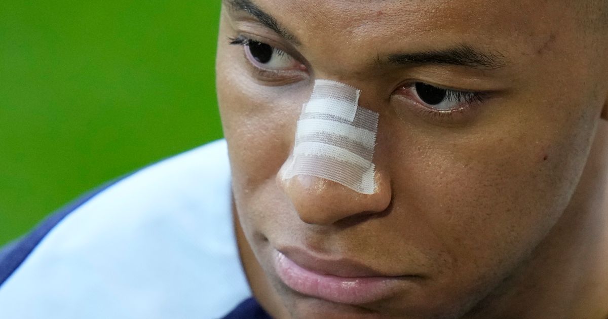 Kylian Mbappé trains at Euro 2024 with bandage on broken nose and ...