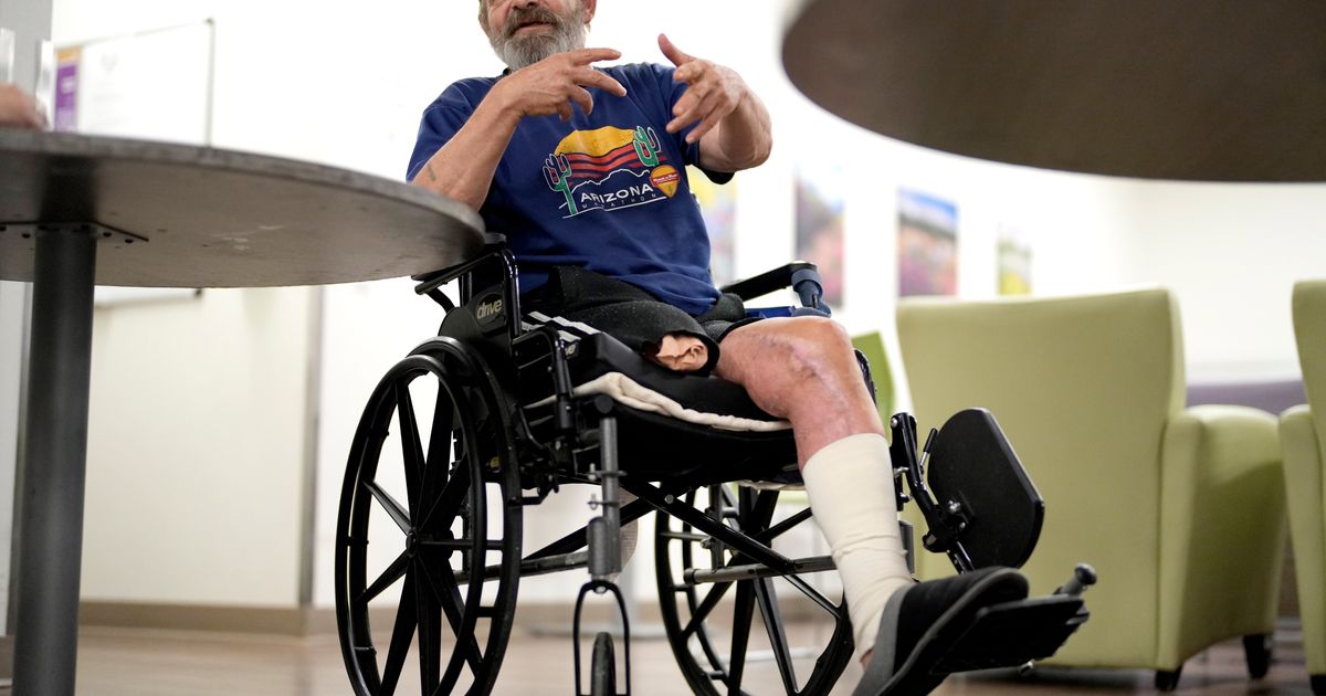 Blazing hot surfaces are a danger for catastrophic burn injuries in the ...