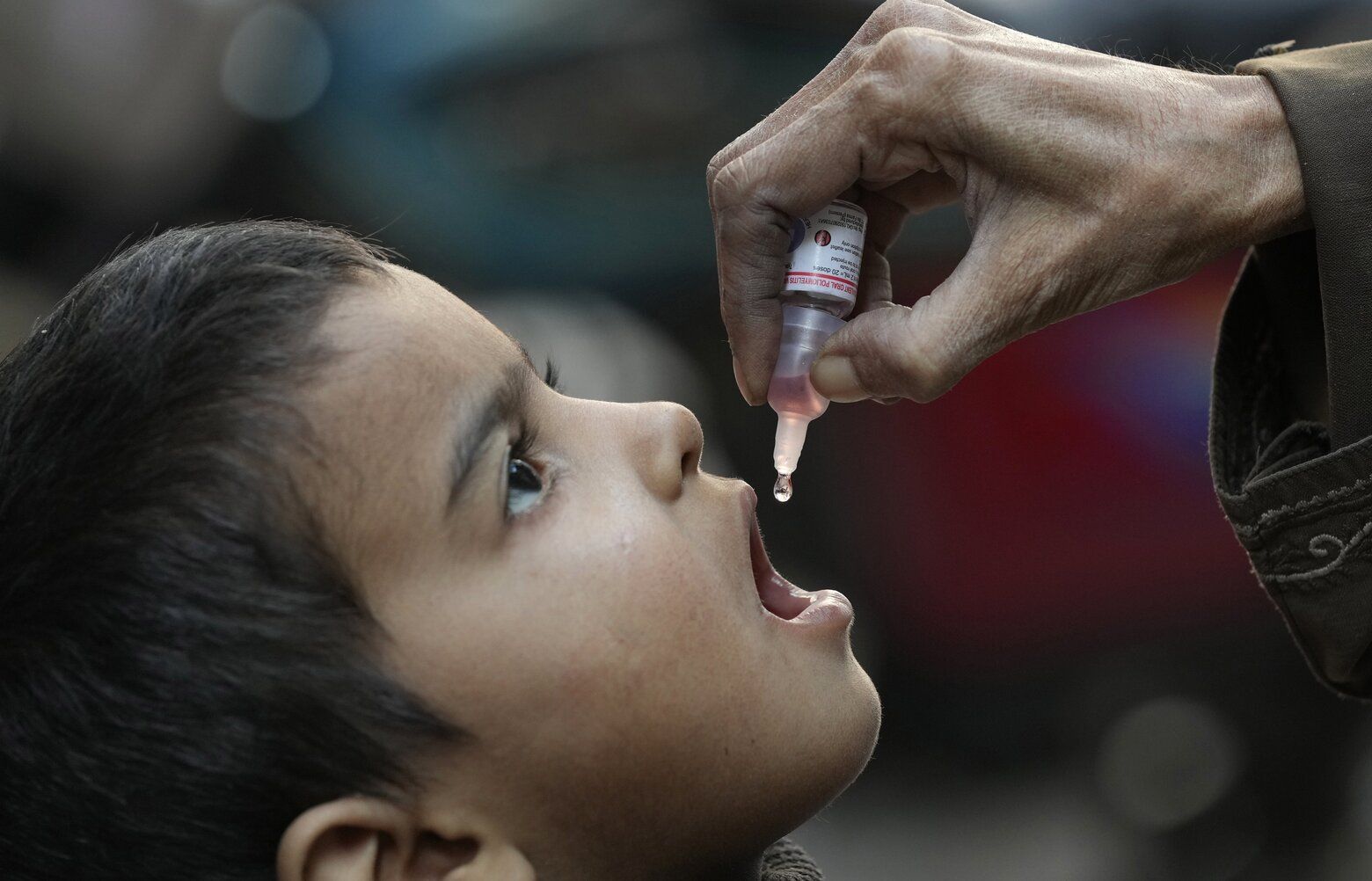 A baby in Gaza has a strain of polio linked to mistakes in eradication ...