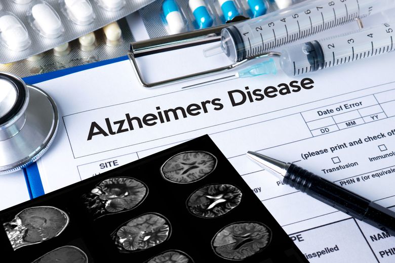 Alzheimer Zeit Für Einen Paradigmenwechsel: Alzheimer Forschung Neu