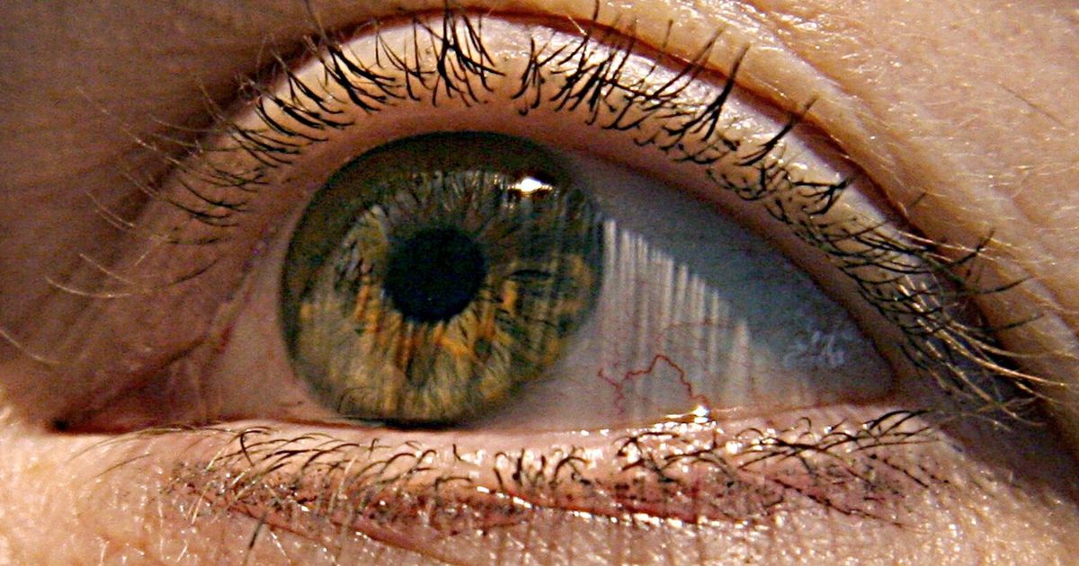 Vision Restored Using Prosthetic Retinal Implant | The Seattle Times