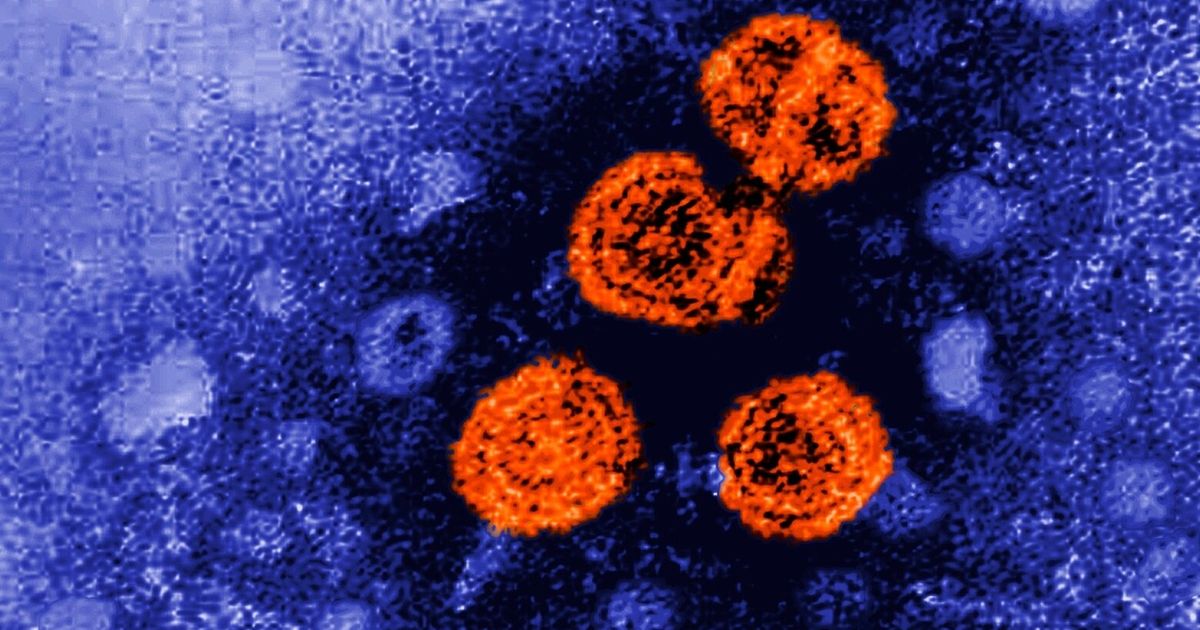 Guinea-Bissau suspends Trump-backed hepatitis B vaccine study for ...