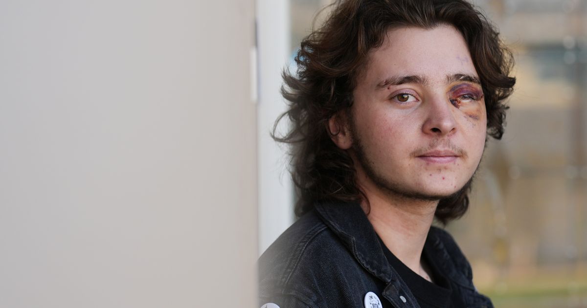 Demonstrator injured after federal agent fired projectile from close ...